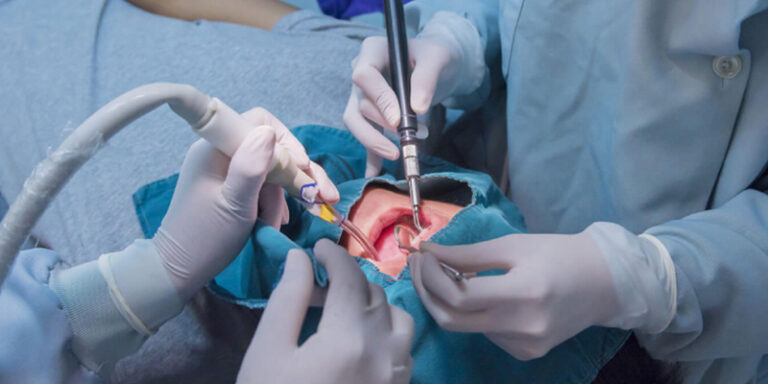 Chirurgia dentale - servizi di Titanium Dental Clinic